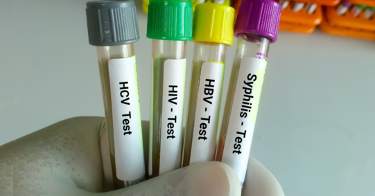 Prof. Anna Wojas-Pelc: choroby przenoszone drogą płciową mogą ...